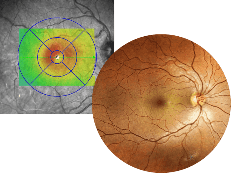 About Tyson Eye | Ophthalmologist Naples | Eye Doctor Fort Myers