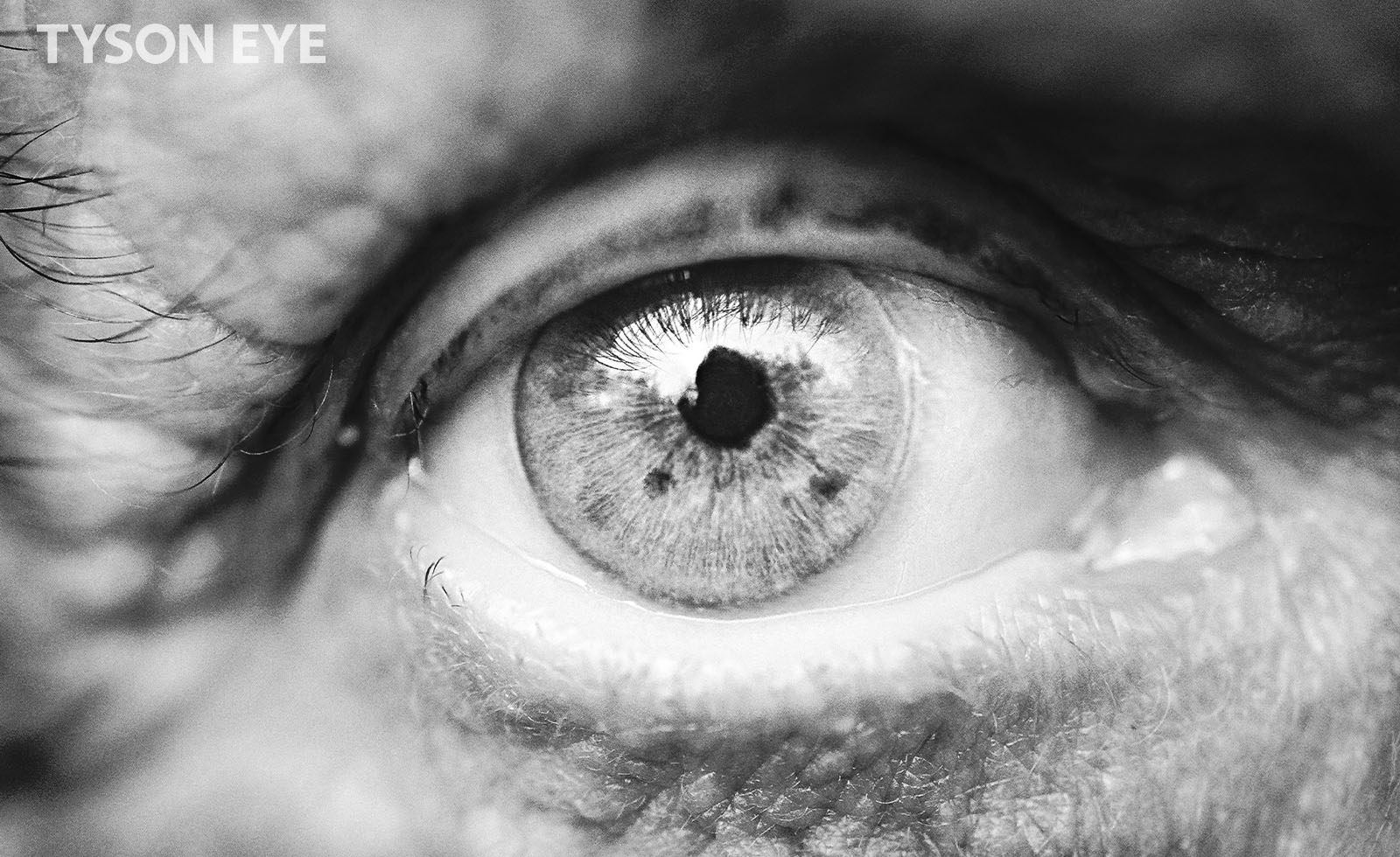 What is the Retina? - Tyson Eye