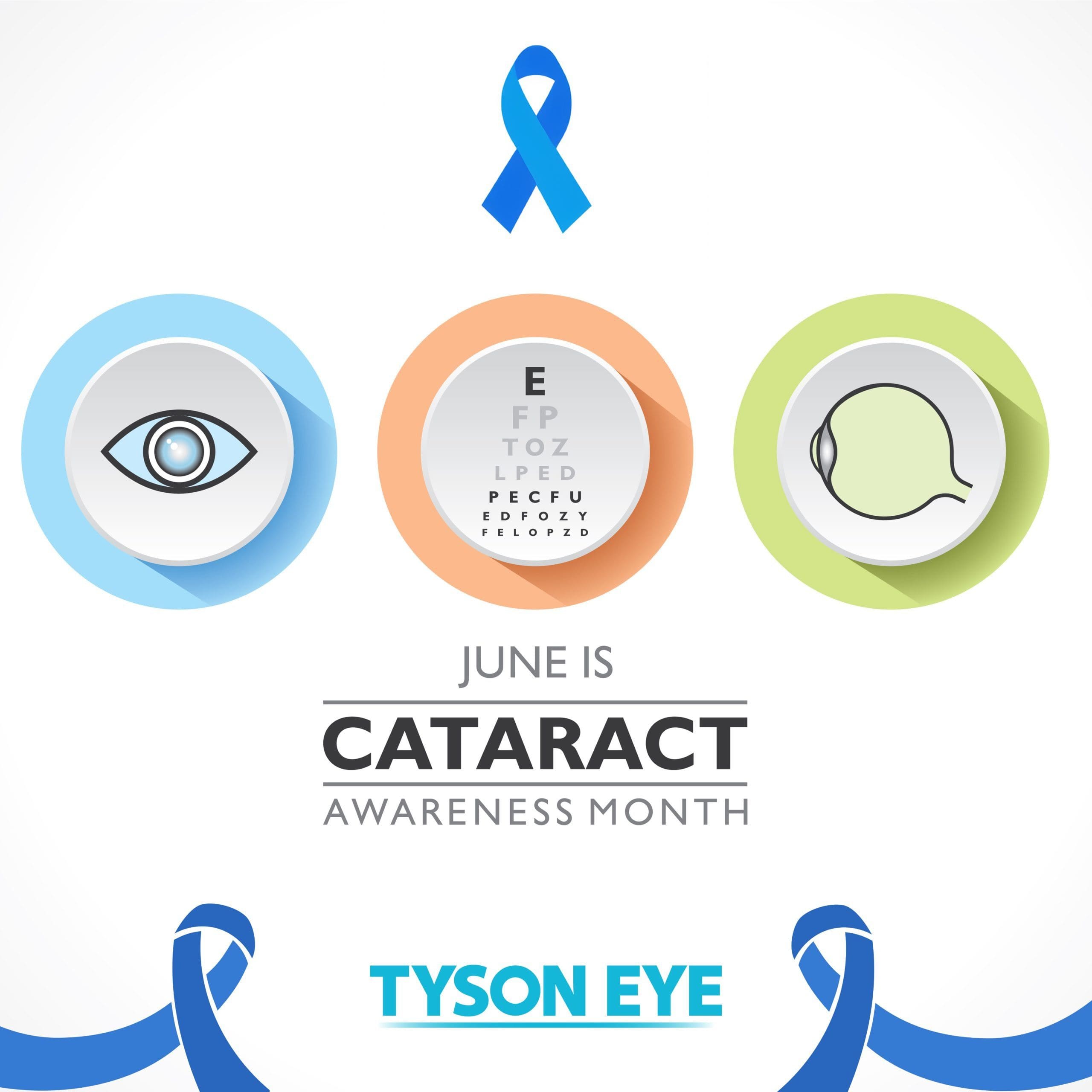 June | National Cataract Awareness Month | Cataract Surgery